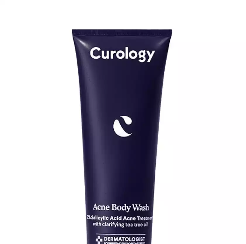 Curology Review After 30+ Days (+ My Curology Before And After!)